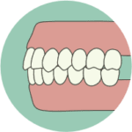 What Are the Three Classes of Orthodontic Treatment - Beverly Hills ...